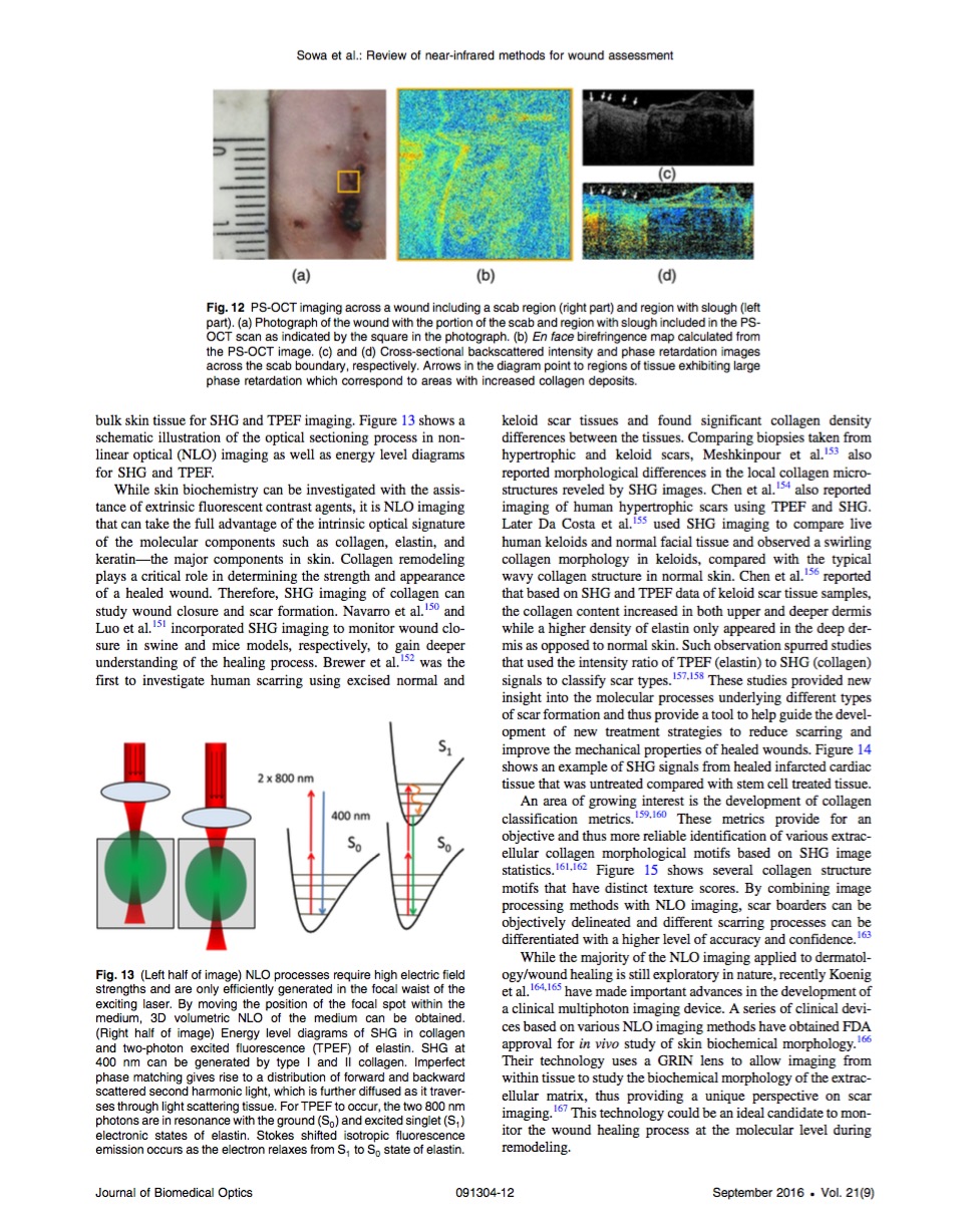 Near Infrared Methods for Wound Assessment: The State of the Art - DF Blog