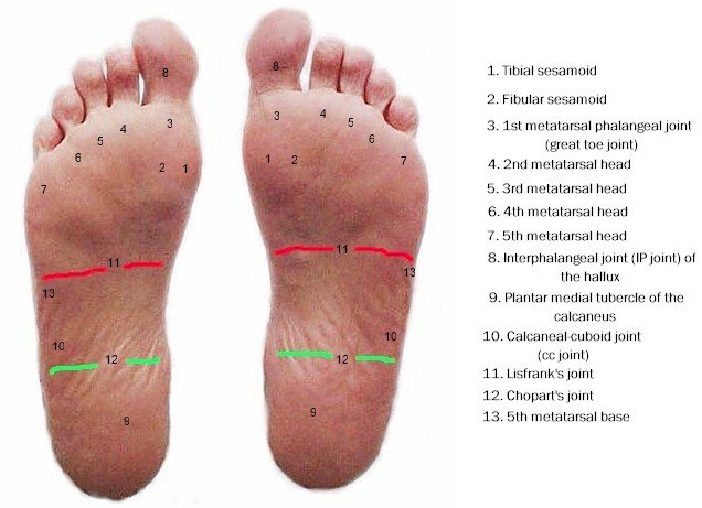 Cumulative Plantar Stress Deeper Insight Into Healed And Non Healed
