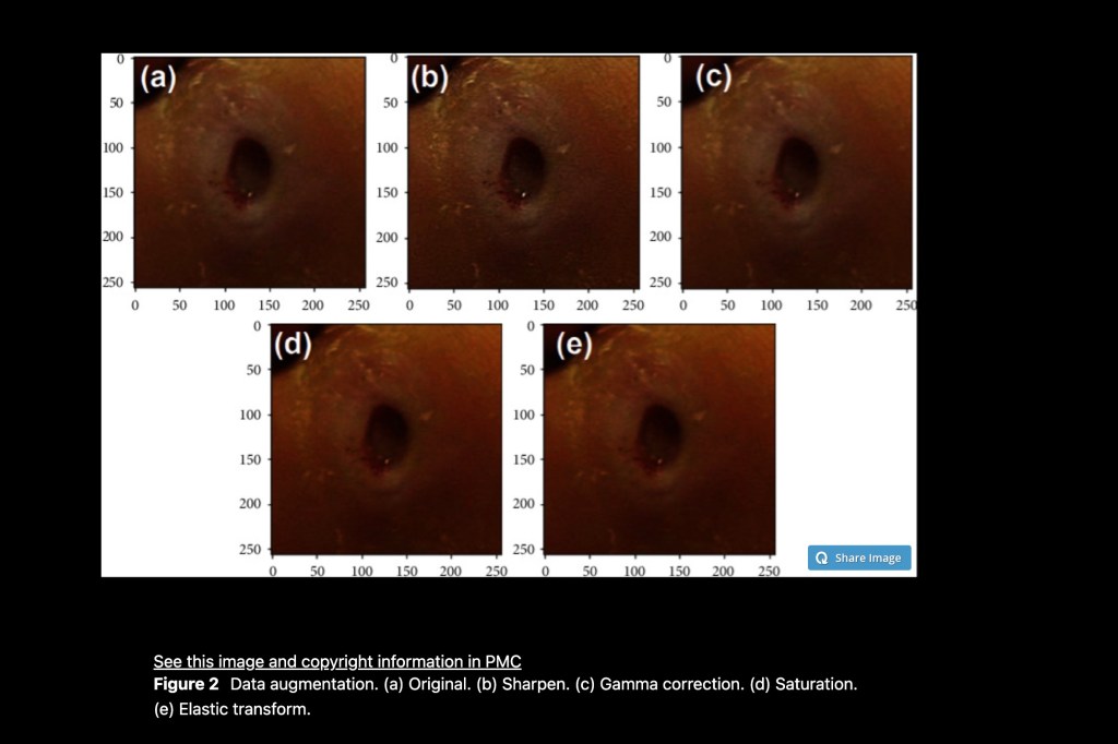 Automated Detection of Infection in Diabetic Foot Ulcer Images #AI # ...
