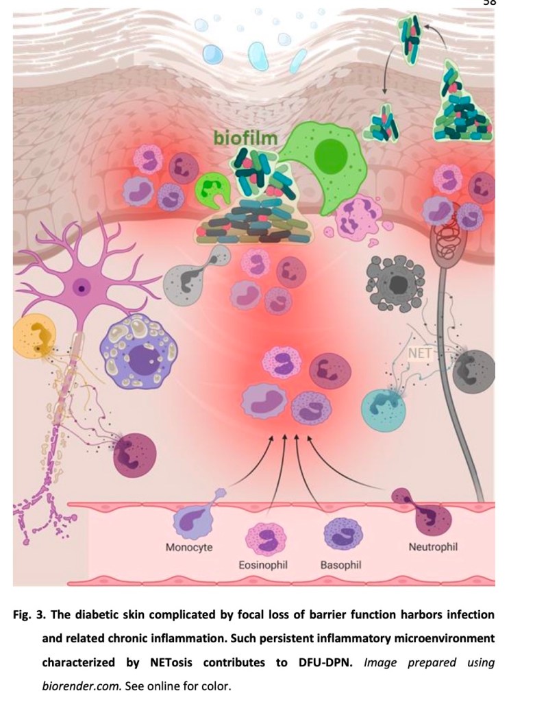 Diabetic Peripheral Neuropathy Associated with Foot Ulcer: One of a ...